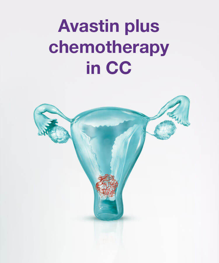Avastin® (bevacizumab) For HCP's | CC Treatment